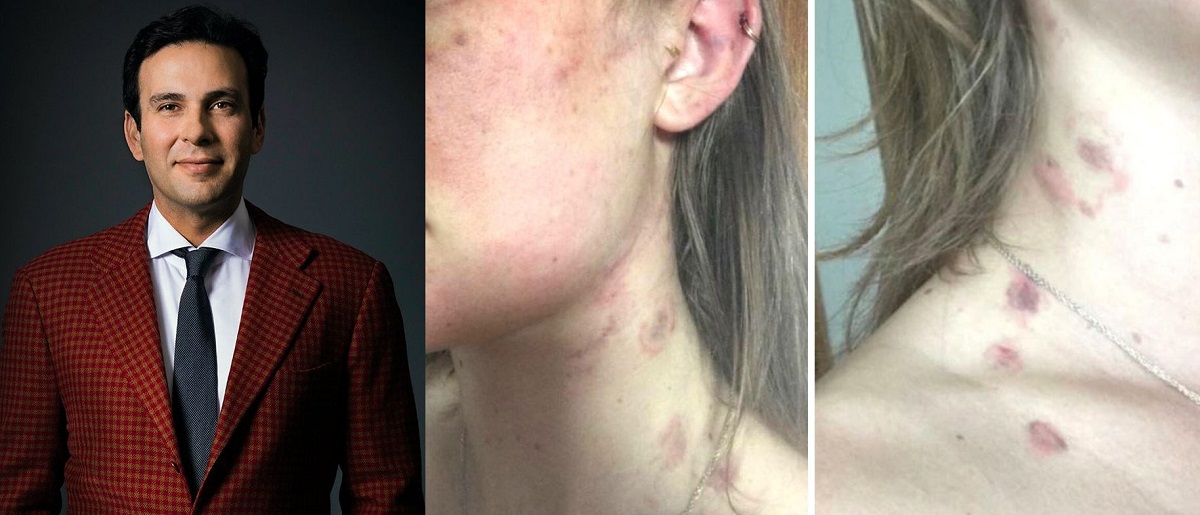 Tatiana Spottiswoode Testifies Accuses Afiniti Ceo Zia Chishti Of